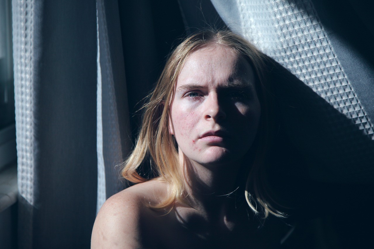 Misinformation About Sun’s Effect on Acne: Sun Exposure Does Not Cure ...