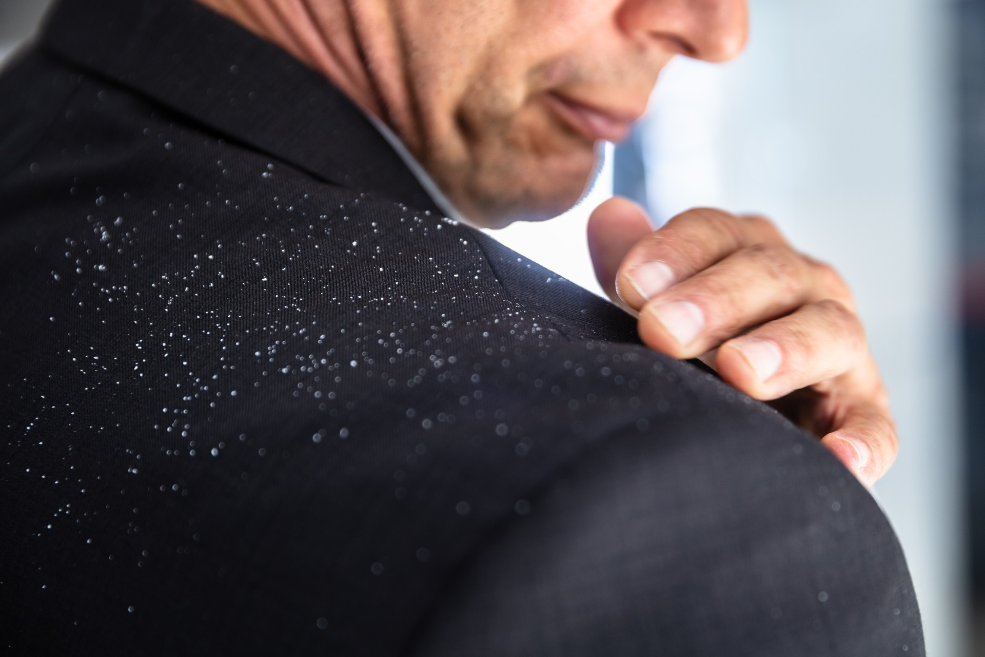 Dermatologist Tips to Treat Dandruff - Buckhead Dermatology